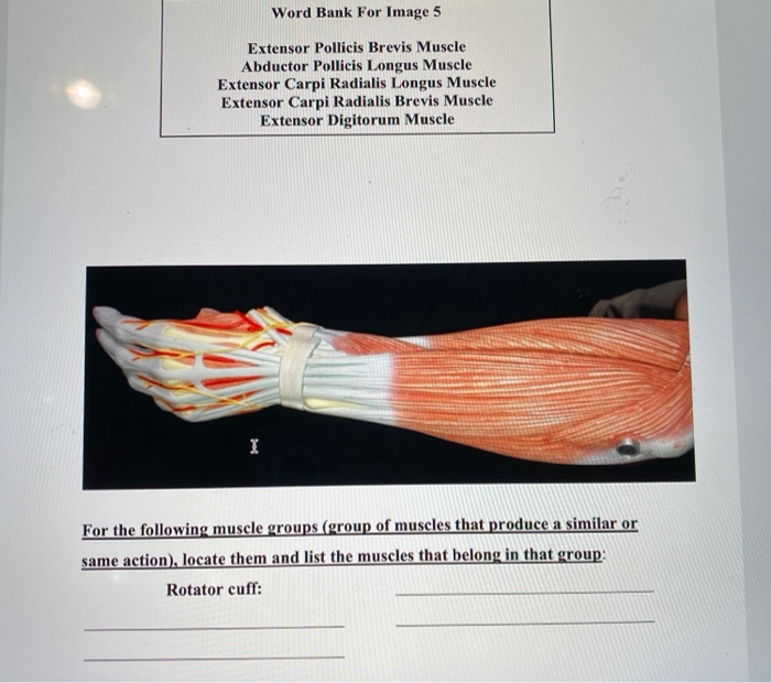 Solved Label the following muscles of the upper limb (don't | Chegg.com
