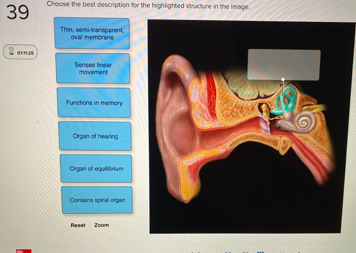 Solved Choose the best description for the highlighted | Chegg.com