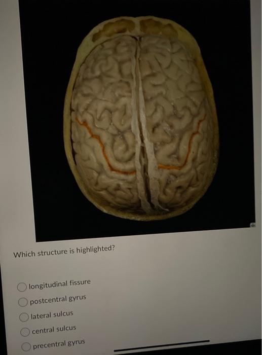 Solved Which structure is highlighted? longitudinal fissure | Chegg.com