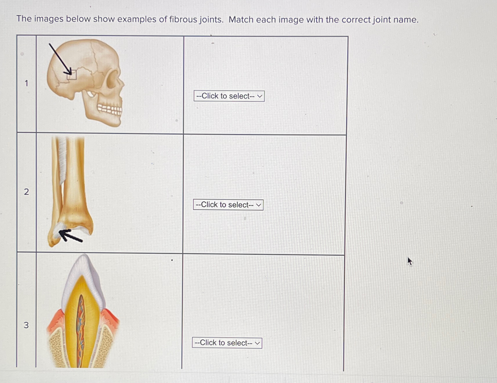 Solved The images below show examples of fibrous joints. | Chegg.com