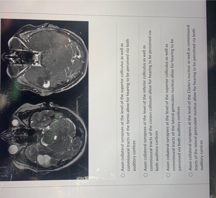 Solved A 68-year-old, right-handed, Spanish-speaking female | Chegg.com