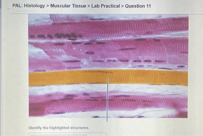 Solved PAL: Histology > Muscular Tissue > Lab Practical > | Chegg.com