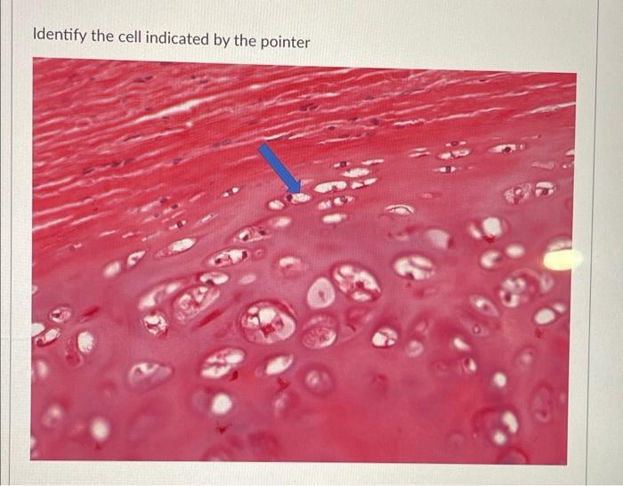 Solved Identify the structure indicated by the pointer | Chegg.com