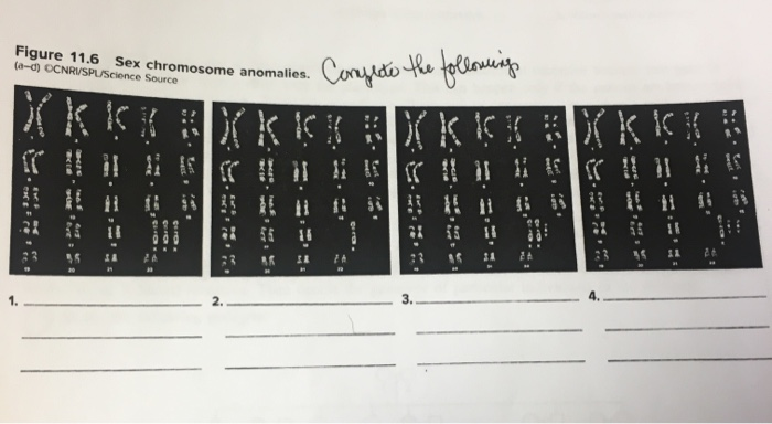 Solved Figure 11 6 Sex Chromosome Anomalies A C