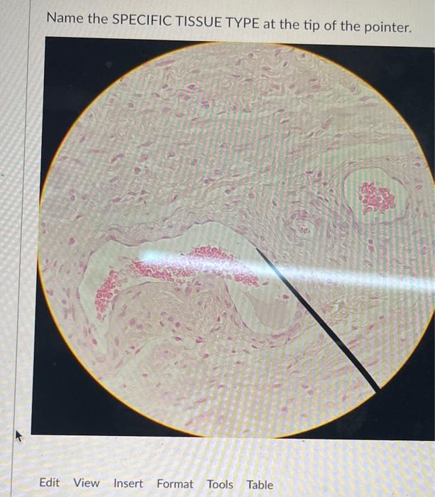 Name the SPECIFIC TISSUE TYPE at the pointer. Name | Chegg.com