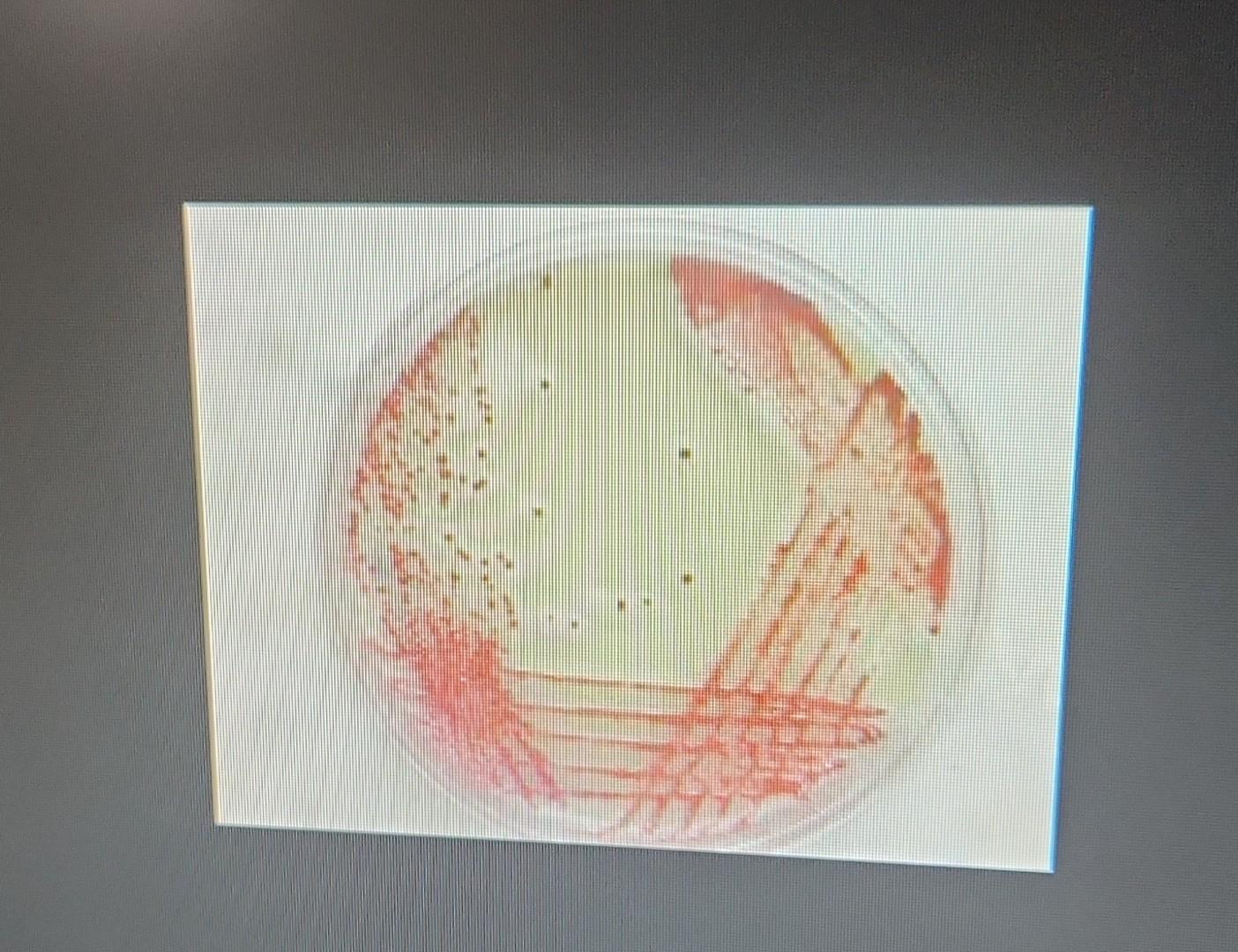 Solved Escherichia coll Proteus vulgaris Enterobacter | Chegg.com