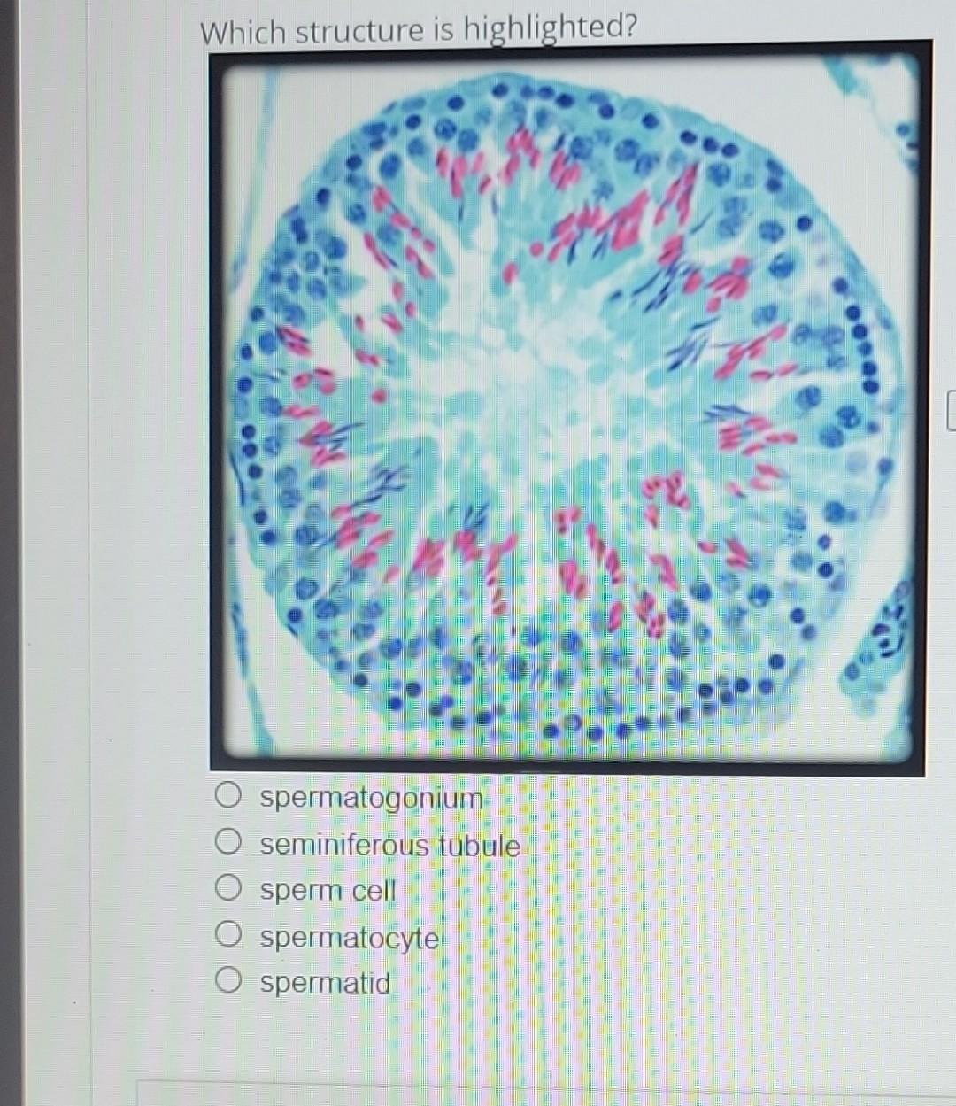 Solved Which structure is highlighted? spermatogonium | Chegg.com