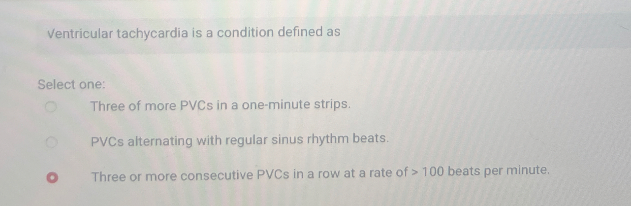 Solved Ventricular tachycardia is a condition defined | Chegg.com