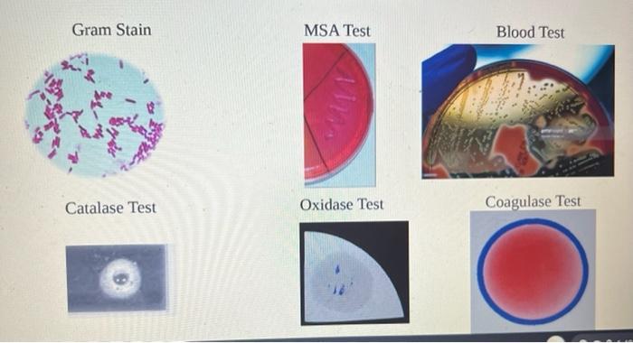 Solved Gram Stain MSA Test Blood Test Catalase Test Oxidase | Chegg.com