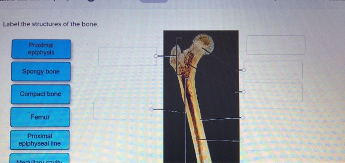Solved Label the structures of the bone. Proximal epiphysis | Chegg.com