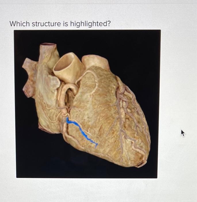 Solved Which structure is highlighted? Multiple Choice left | Chegg.com