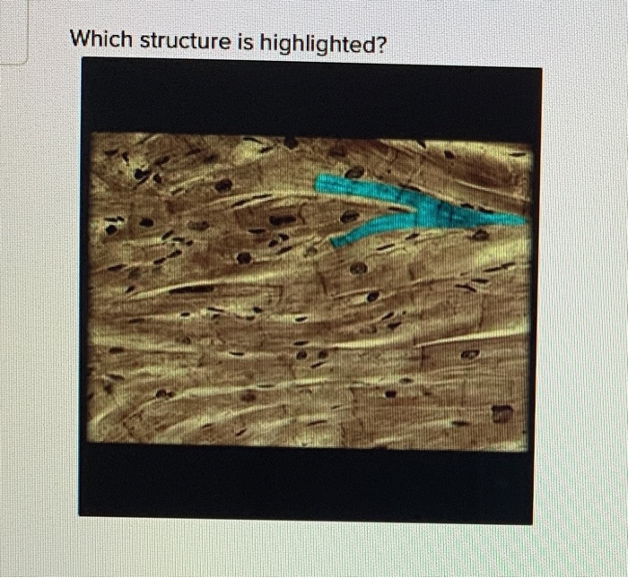 Solved Which structure is highlighted? Which structure is | Chegg.com