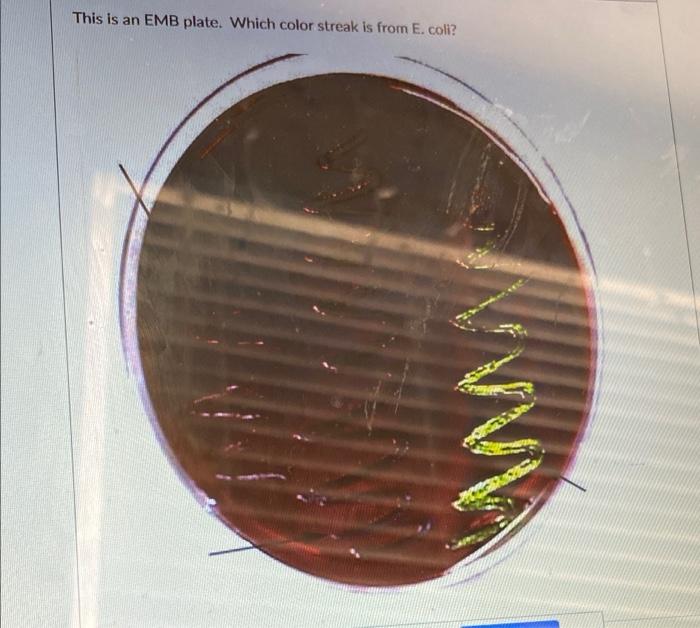 Solved This is an EMB plate. Which color streak is from E. | Chegg.com