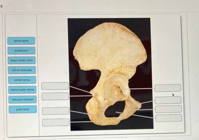 Solved 3 ischial spine acetabulum lesser sciatic notch | Chegg.com