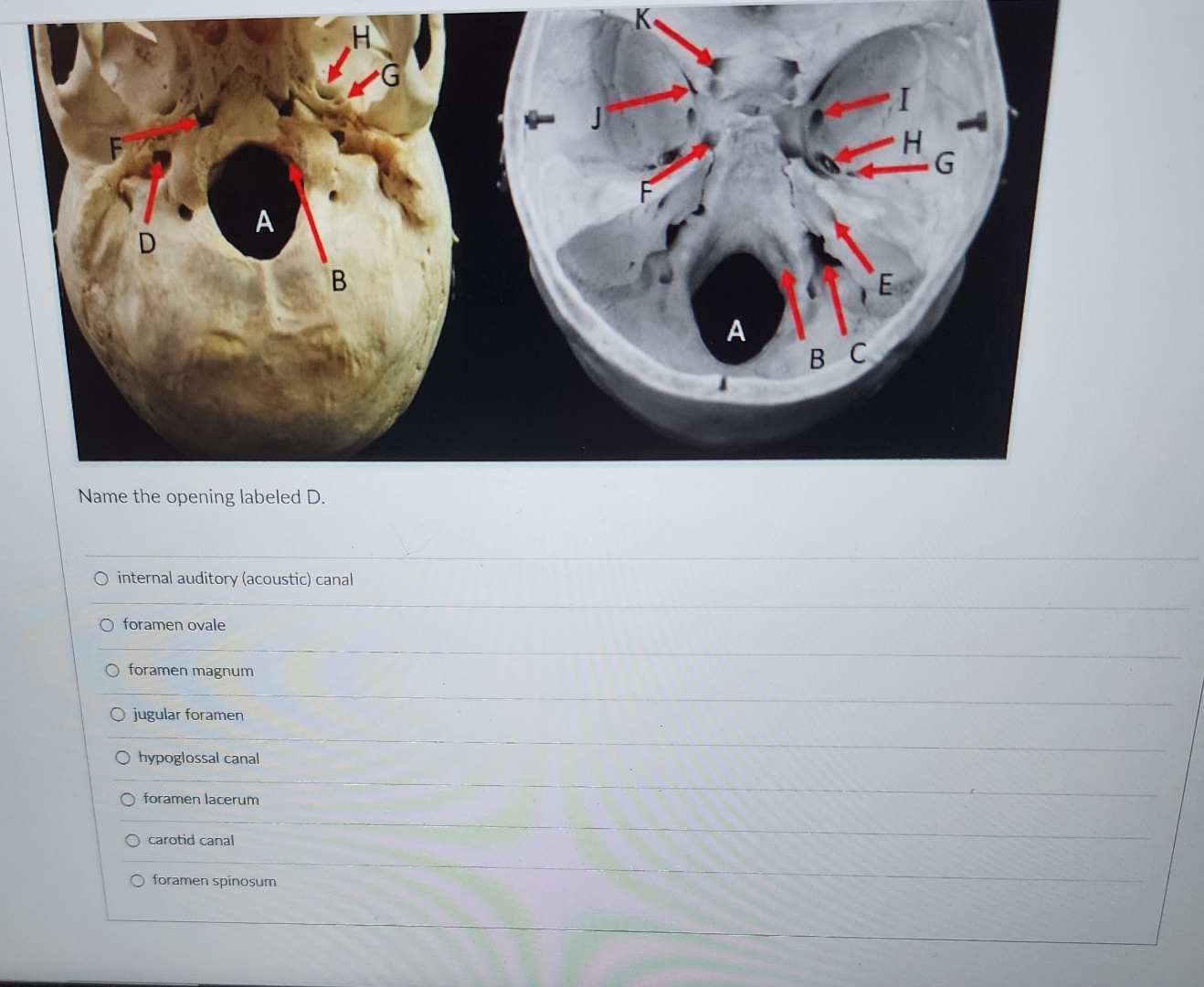Solved Name the opening labeled D.internal auditory | Chegg.com