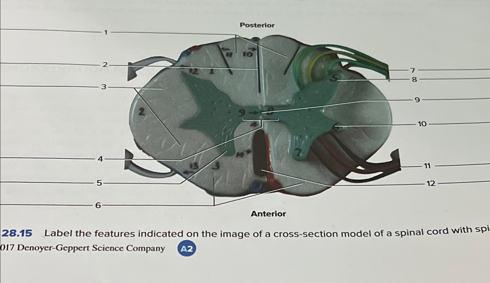 Solved 28.15 ﻿Label the features indicated on the image of a | Chegg.com