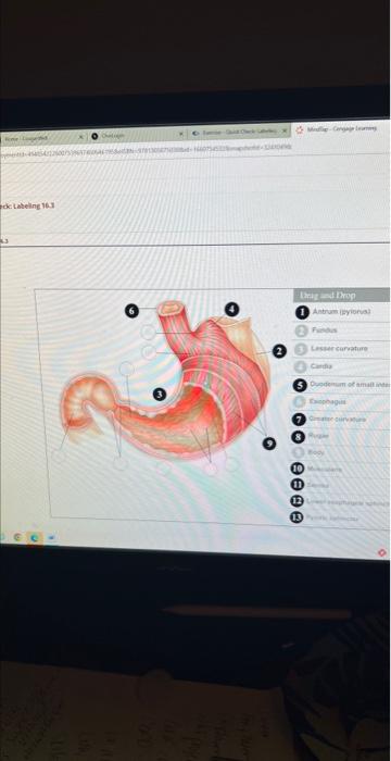 Solved Put the steps into the correct order to trace the | Chegg.com