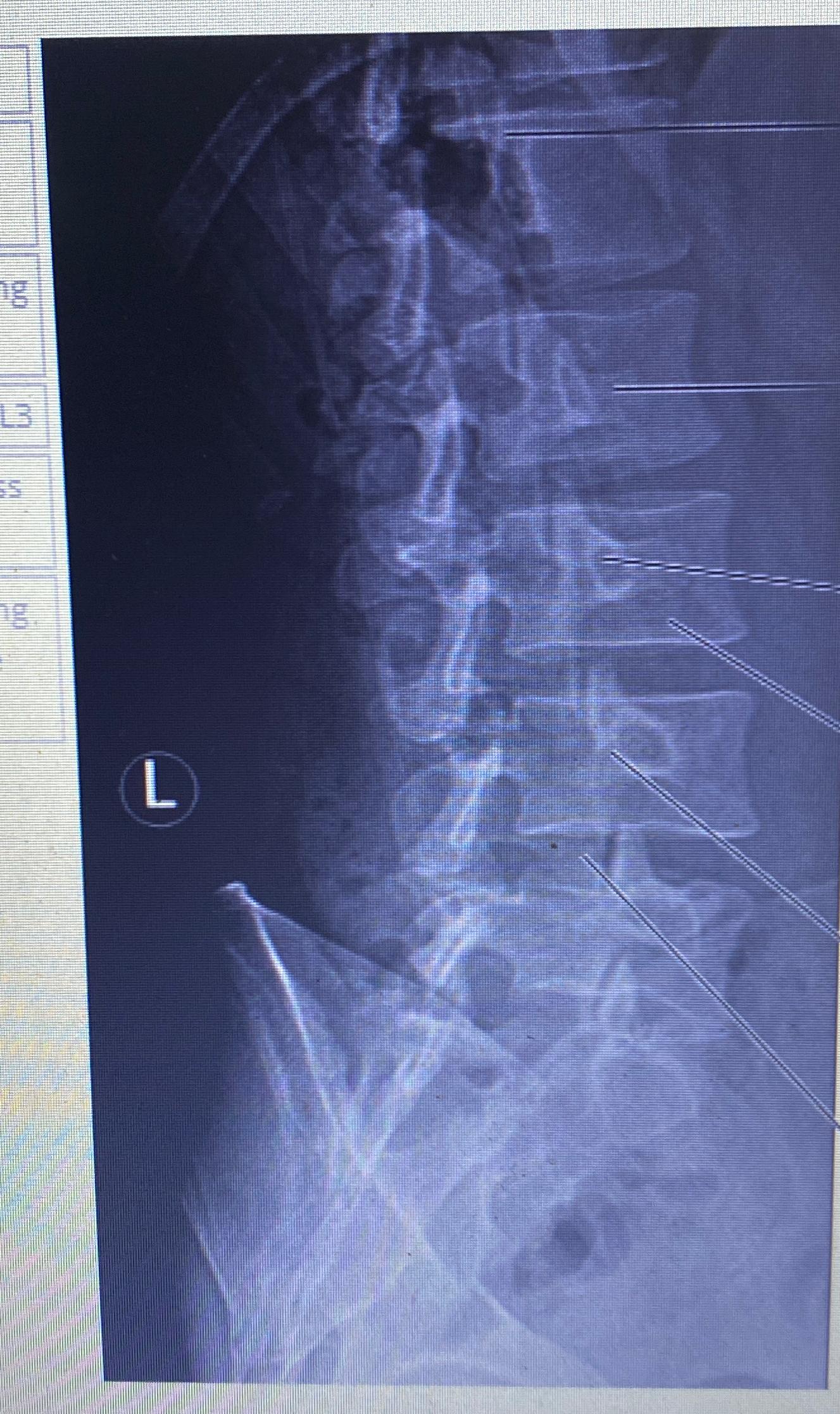 Solved Which hipIs touching the bucky on a righ posterior | Chegg.com
