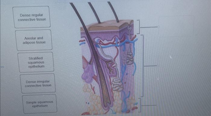 Solved Dense regular connective tissue Areolar and adipose | Chegg.com