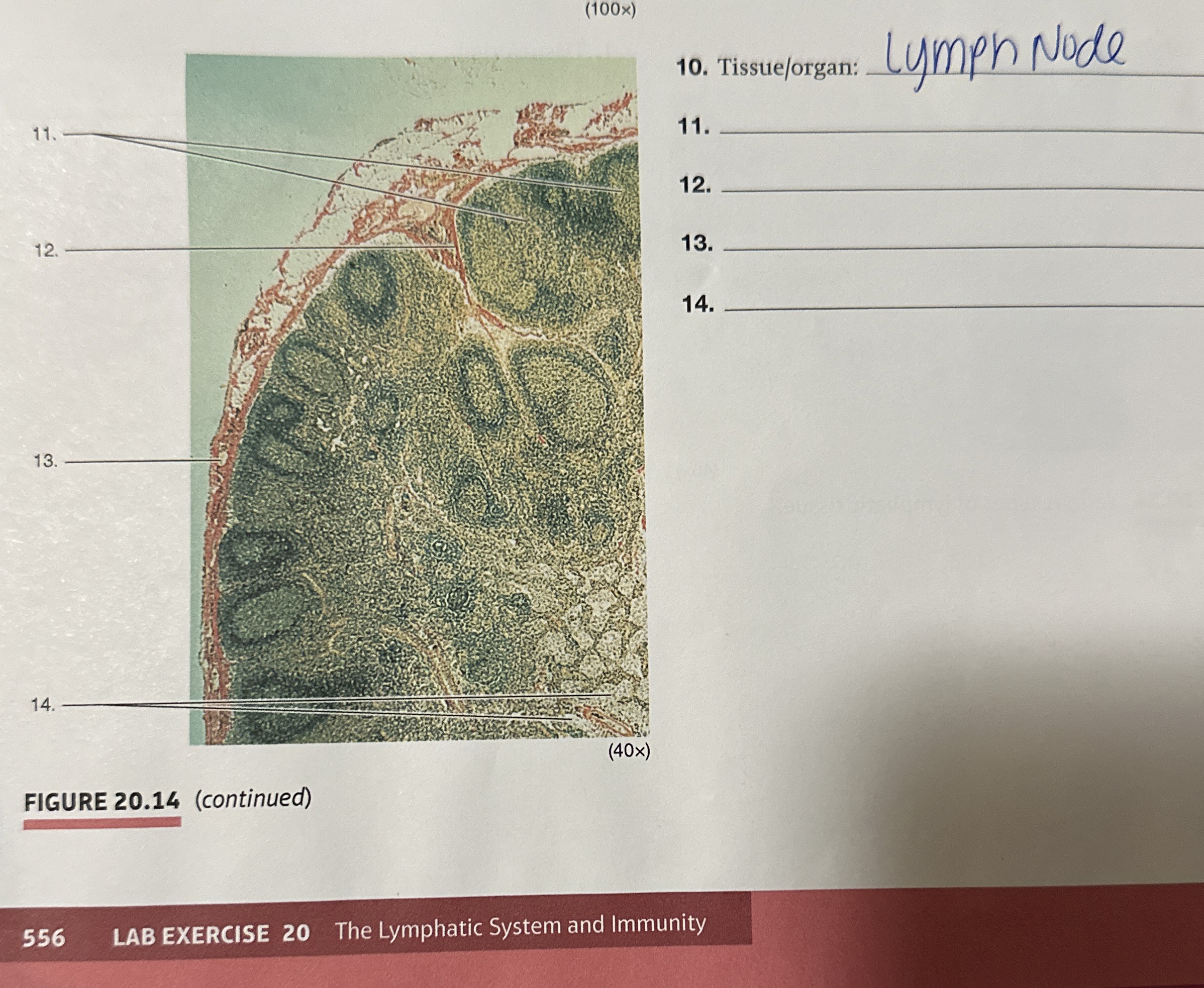 Solved (100x)10. ﻿Tissuelorgan: Lymph | Chegg.com
