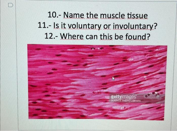 Solved 10.- Name the muscle tissue 11.- Is it voluntary or | Chegg.com