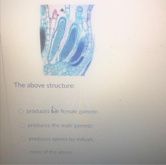 Solved The above structure: produces the female gamete. | Chegg.com