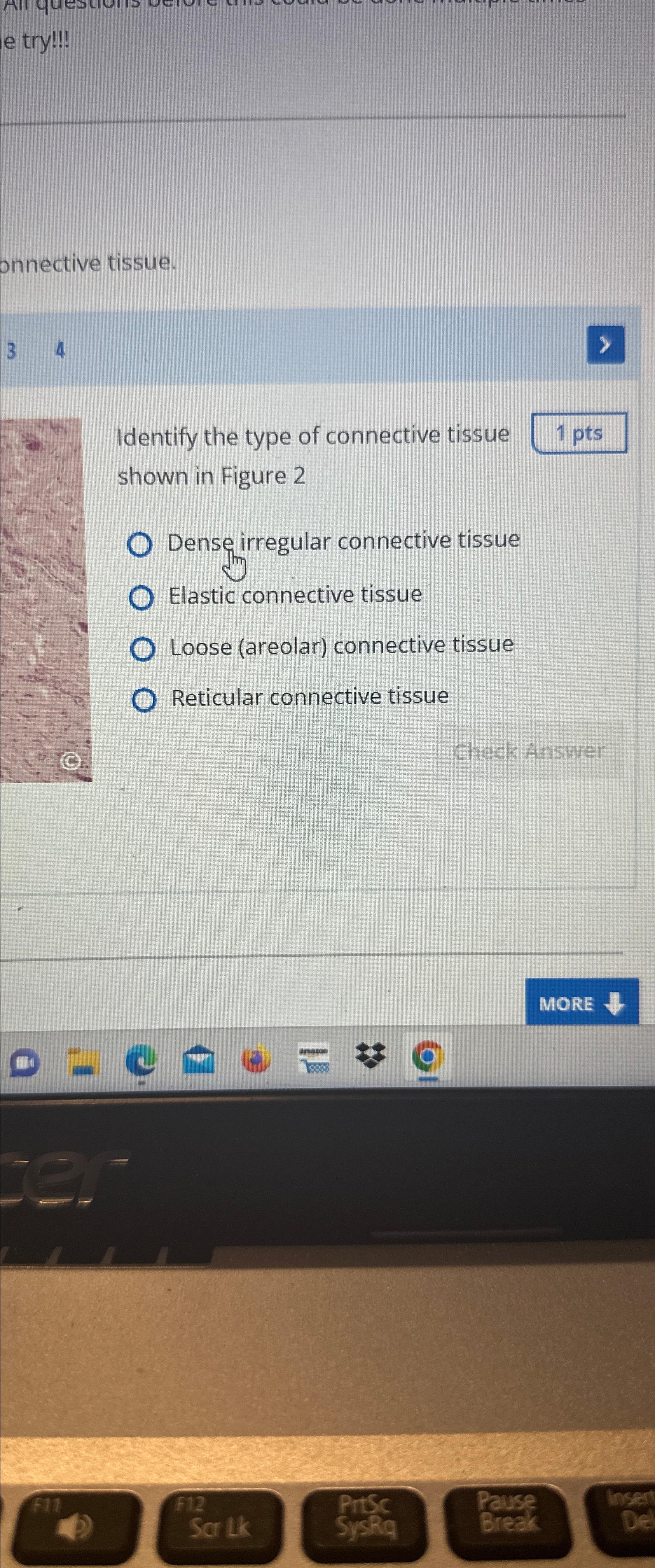 Solved e try!!!onnective tissue.34Identify the type of | Chegg.com