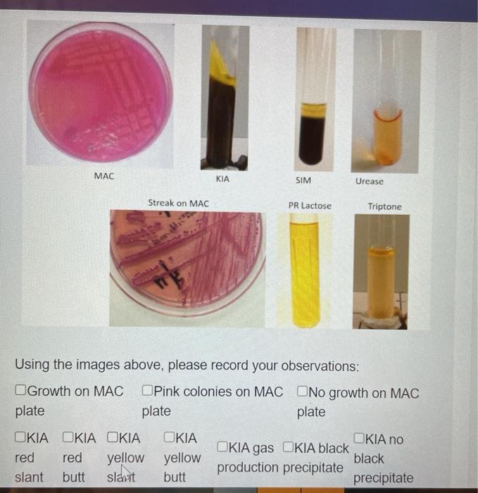 Solved MAC KIA SIM Urease Streak on MAC PR Lactose Triptone | Chegg.com