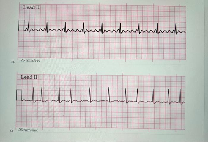 Solved - The underlying rhythm name is appropriately | Chegg.com