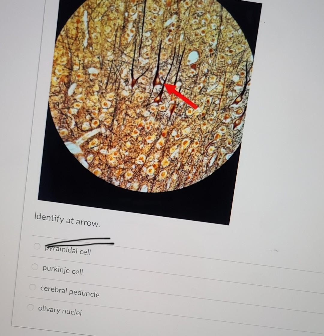 Solved endoneurium epineurium myelin perineurium Previous | Chegg.com