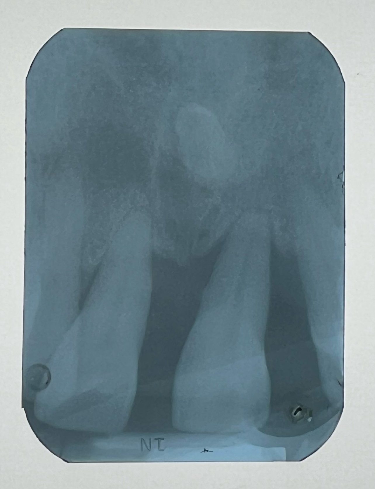 Solved Below is IOPAR IRT 11 ﻿& 21Interpret below radiograph | Chegg.com