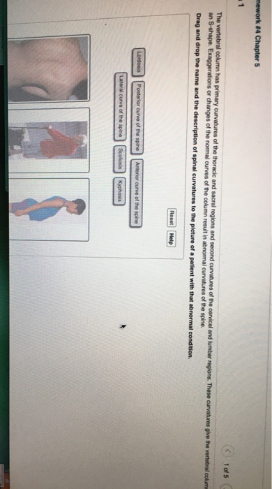 Solved mework #4 Chapter 5 1 1 of 5 G The vertebral column | Chegg.com Solved mework #4 Chapter 5 1 1 of 5 G The vertebral column | Chegg.com