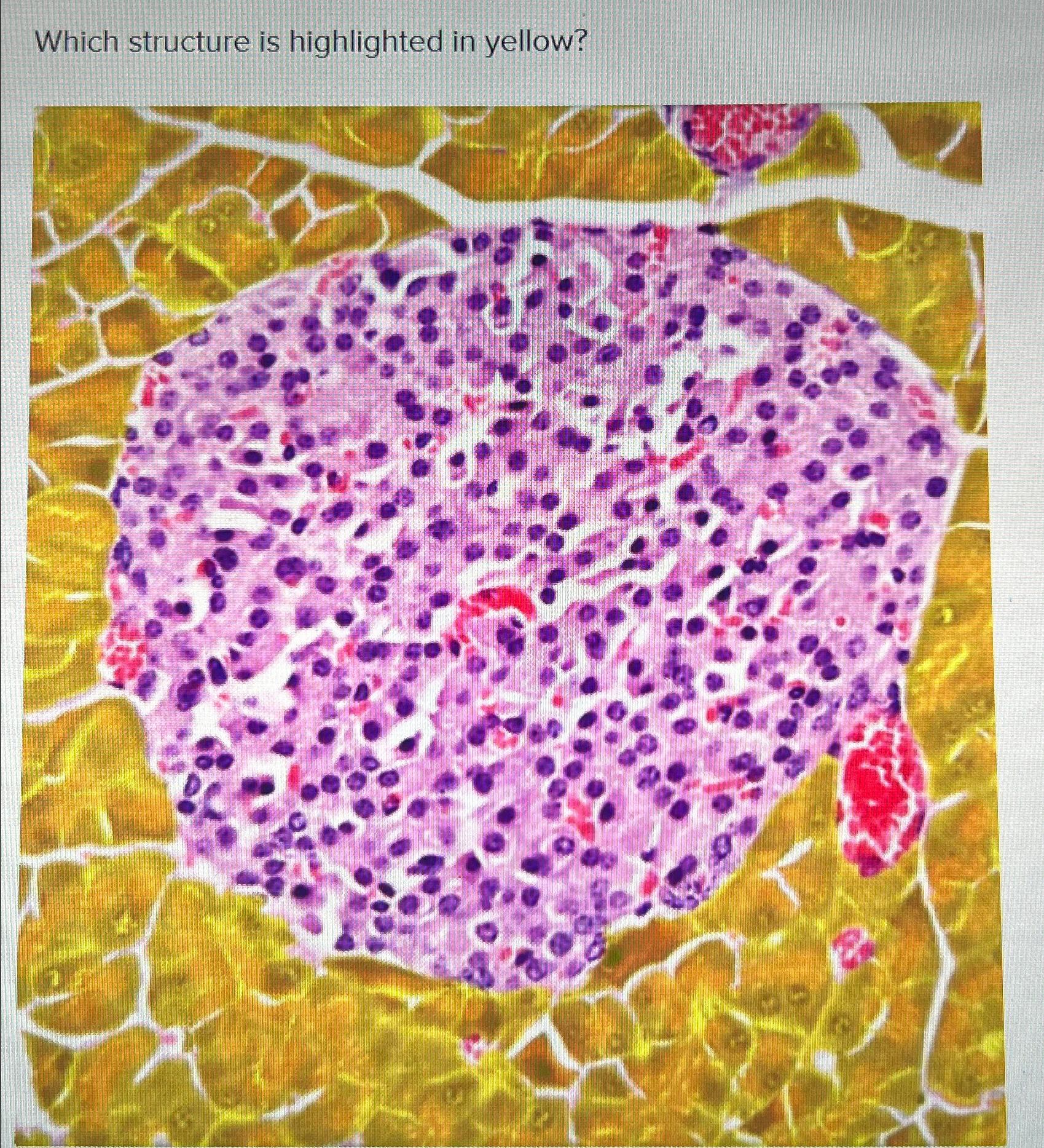 Solved Which structure is highlighted in yellow? | Chegg.com