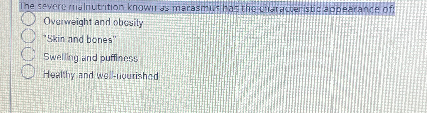 Solved The severe malnutrition known as marasmus has the | Chegg.com