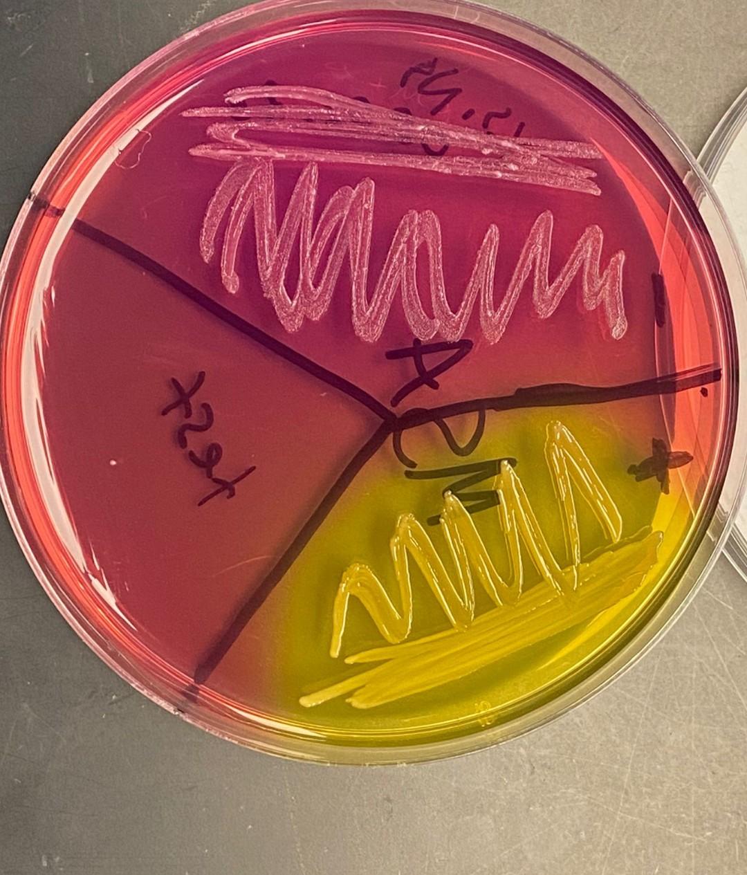 Solved 1. a) Figure 1: Results of selective and differential | Chegg.com