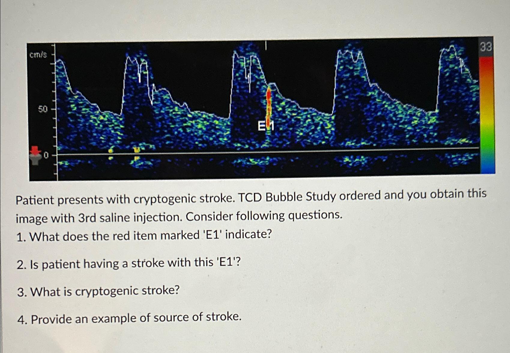 Solved Patient presents with cryptogenic stroke. TCD Bubble | Chegg.com
