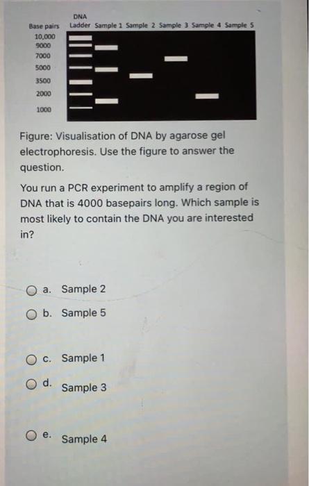 Solved DNA Ladder Sample 1 Sample 2 Sample 3 Sample 4 Sample | Chegg.com