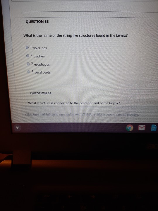 Solved QUESTION 33 What is the name of the string like | Chegg.com