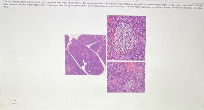 of theol hievened with bandt of mooth matal stain | Chegg.com