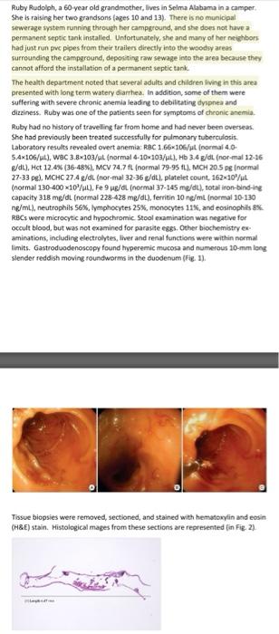 Ruby Rudolph, a 60 year old grandmother, lives in | Chegg.com