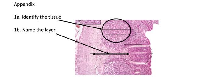 Solved Appendix 1a. Identify the tissue 1b. Name the layer | Chegg.com