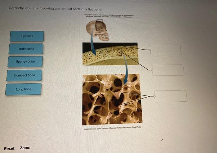 Solved Correctly label the following anatomical parts of a | Chegg.com