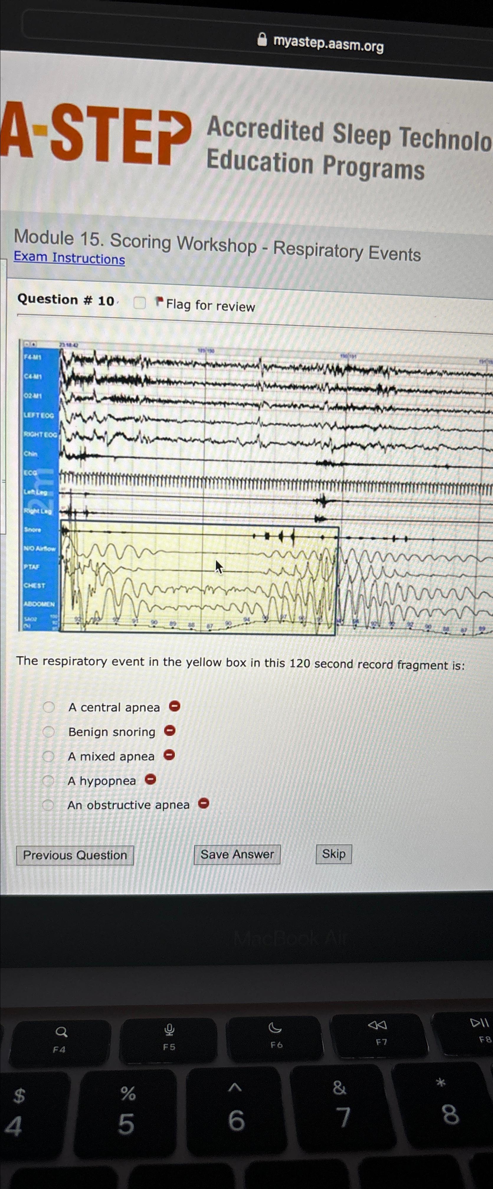 Solved myastep.aasm.orgA=8Accredited Sleep Technolo | Chegg.com