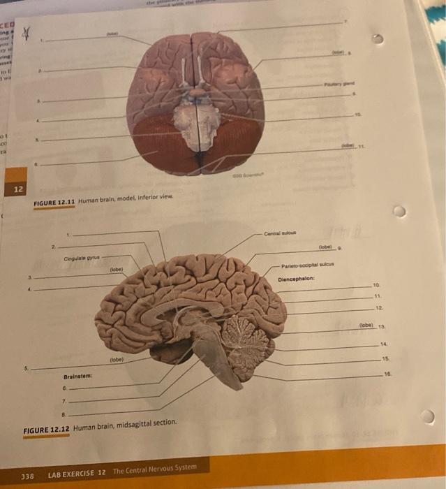 Solved FIGURE 12.10 Human brain, model, superior | Chegg.com