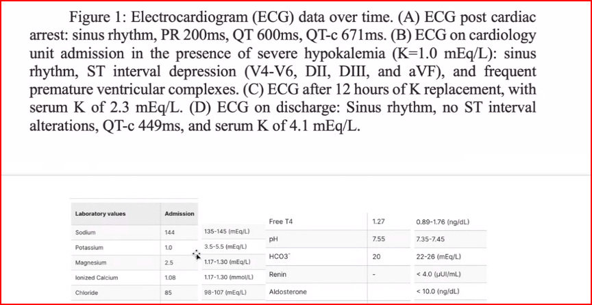 Solved Figure 1: Electrocardiogram (ECG) ﻿data over time. | Chegg.com