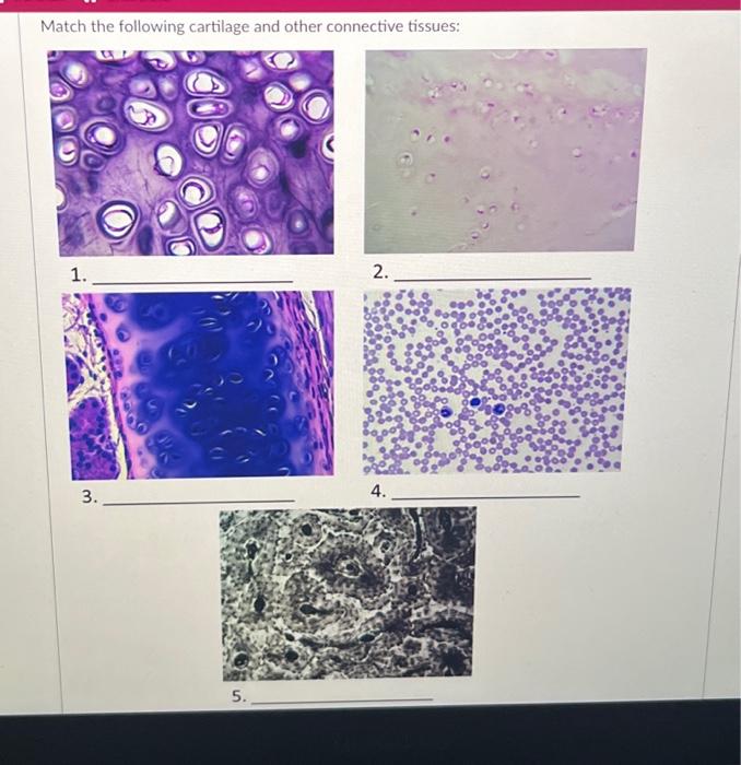Solved Match the following cartilage and other connective | Chegg.com