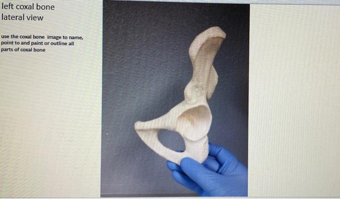 Solved Left Coxal Bone Lateral View -- name, point to and | Chegg.com