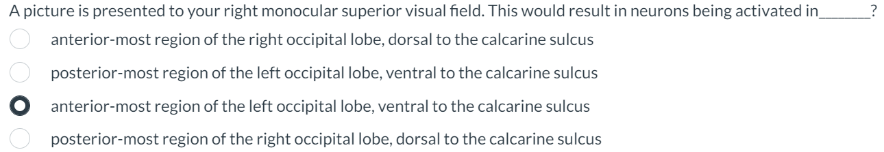 Solved A picture is presented to your right monocular | Chegg.com