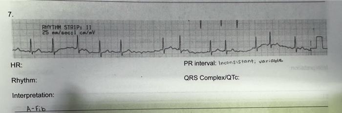 Solved 6.7. HR: PR interval: Inconsistant; variable. Rhythm: | Chegg.com