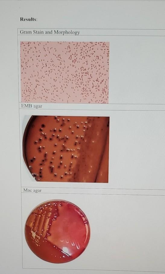 Virtual Gram Negative Unknown Lab Name Section | Chegg.com Virtual Gram Negative Unknown Lab Name Section | Chegg.com